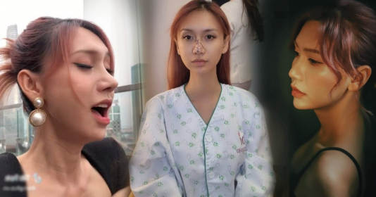 Lynk Lee tuyên bố đã trở thành gái xịn sau 8 lần dao kéo khiến fans ...